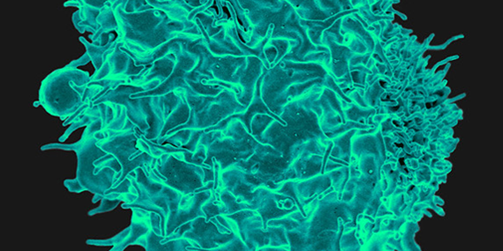 Study reveals experimental targets for lymphoma research