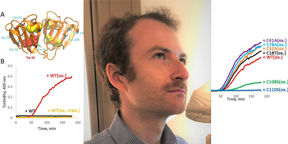 Serebryany honored for work on cataracts