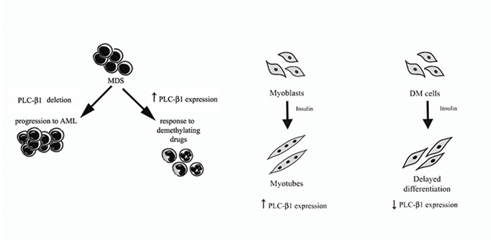 PI-PLC β1 in differentiation and disease
