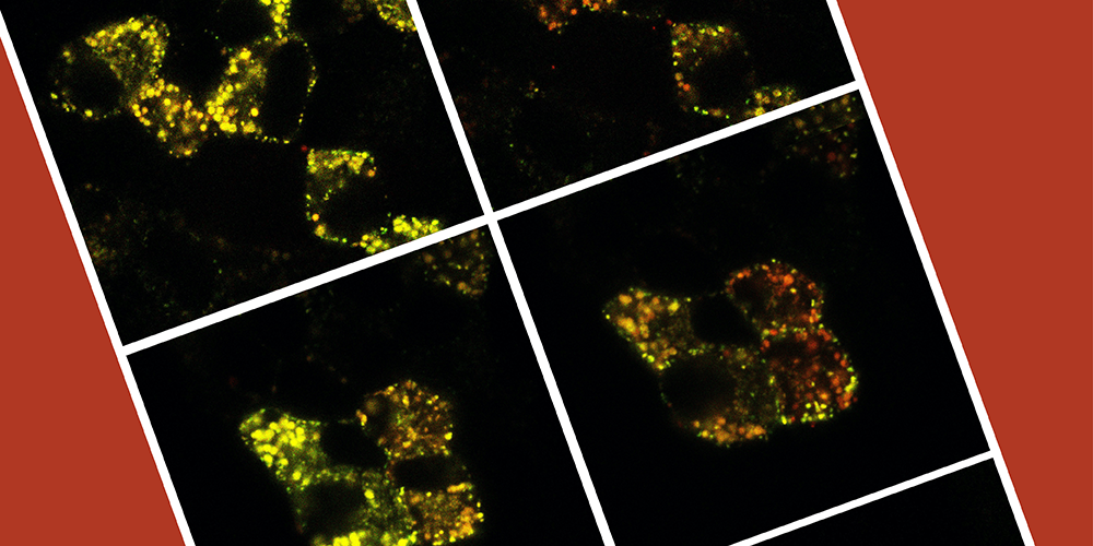 Sorting and secreting insulin by expiration date