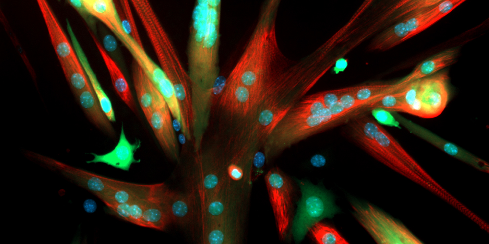 From the journals: JBC