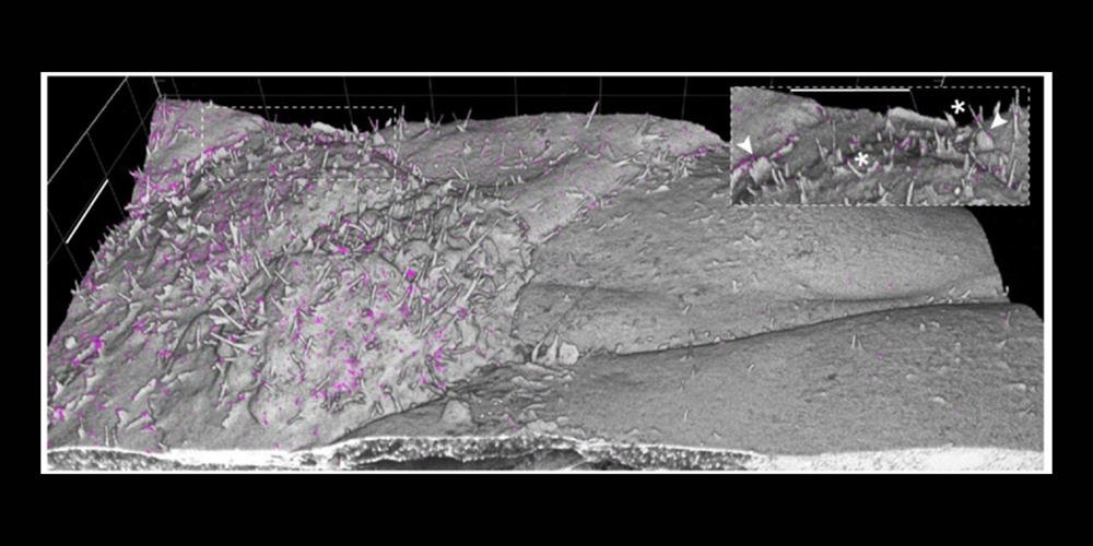 Expansion microscopy ‘grows’ samples larger for super-resolution imaging