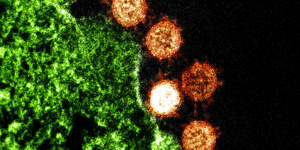 Gain-of-function research: All in the eye of the beholder