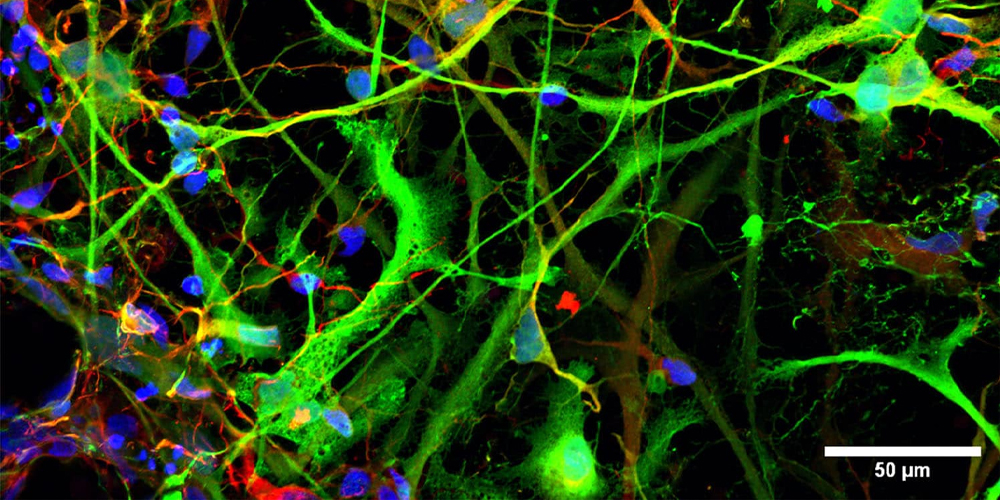 Stem cell–derived model offers insights on gene activity and addiction