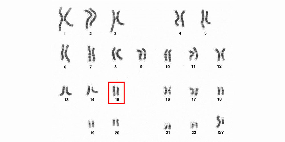 Today is International 15q Day