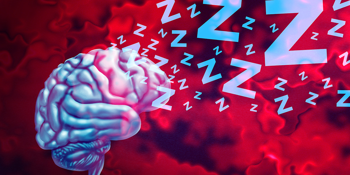 How Alixorexton could transform narcolepsy treatment
