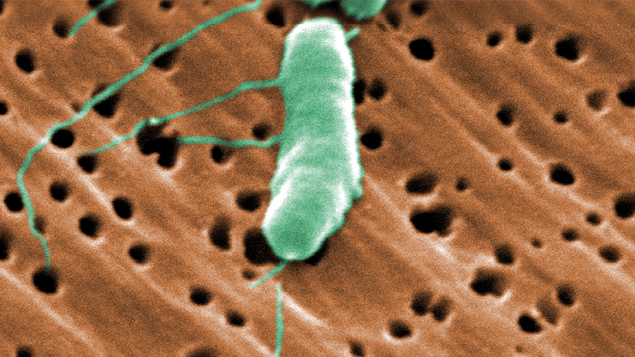 Necrotizing Fasciitis Bacteria Structure