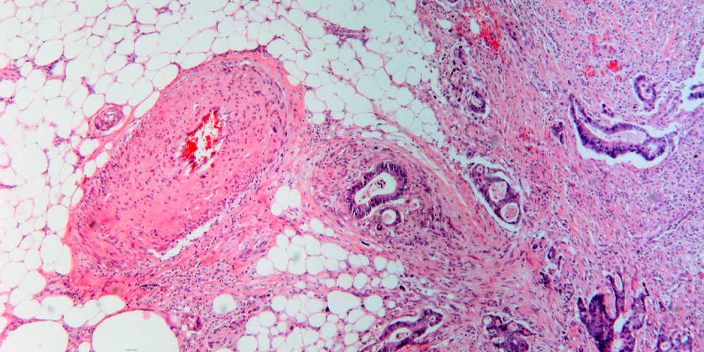 From the journals: MCP