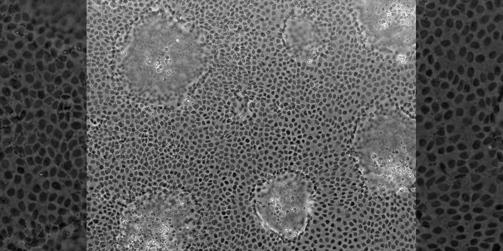 Gut microbes could be key for cancer therapies