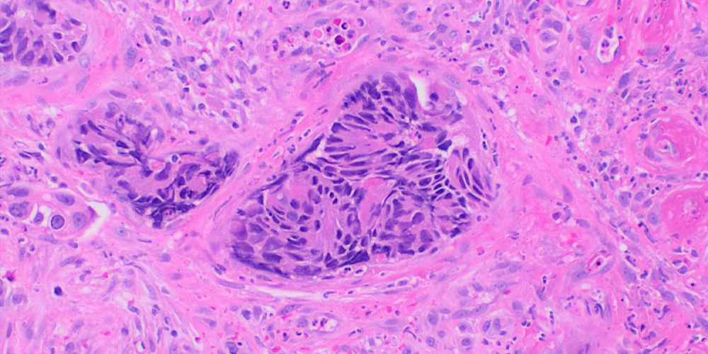 From the journals: MCP