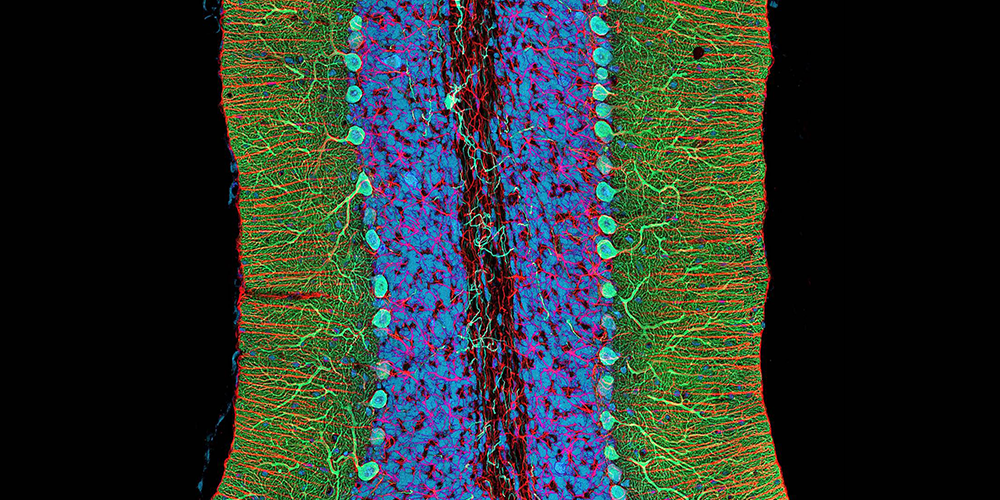Addgene expands its collection into antibodies