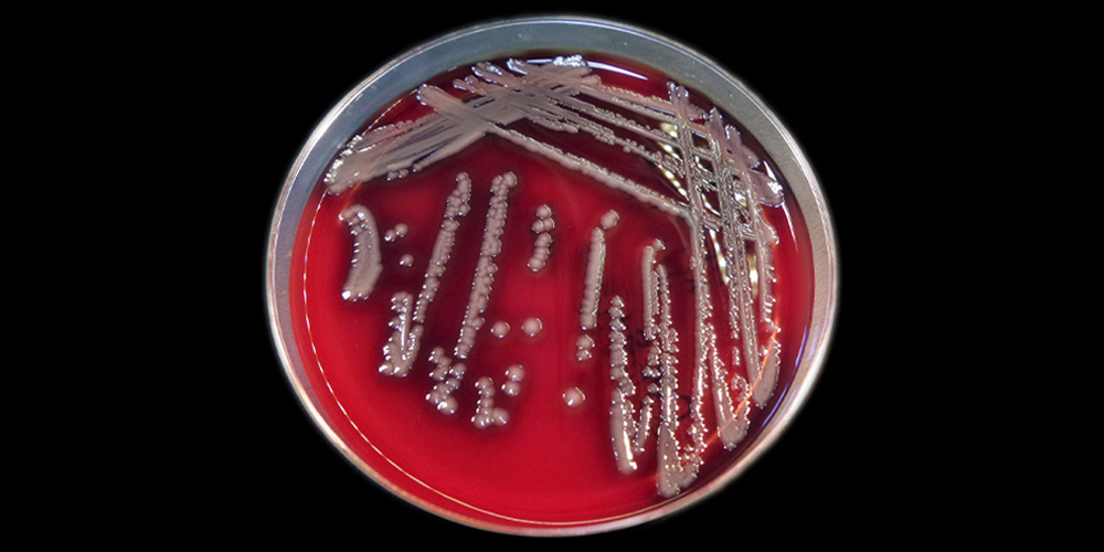 How a fish pathogen outwits antibiotic stress