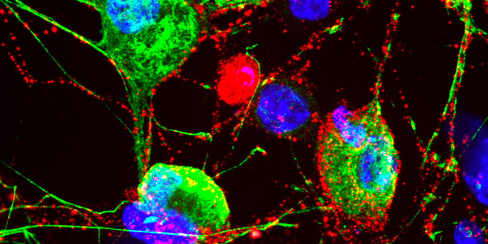 Cell’s ‘garbage disposal’ may have another role