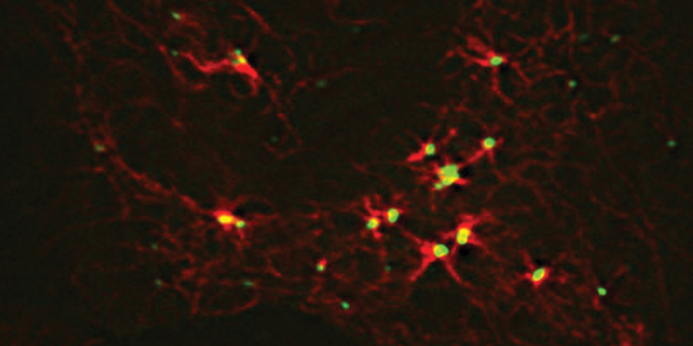 JBC: A shadowy organizational hub in cells
